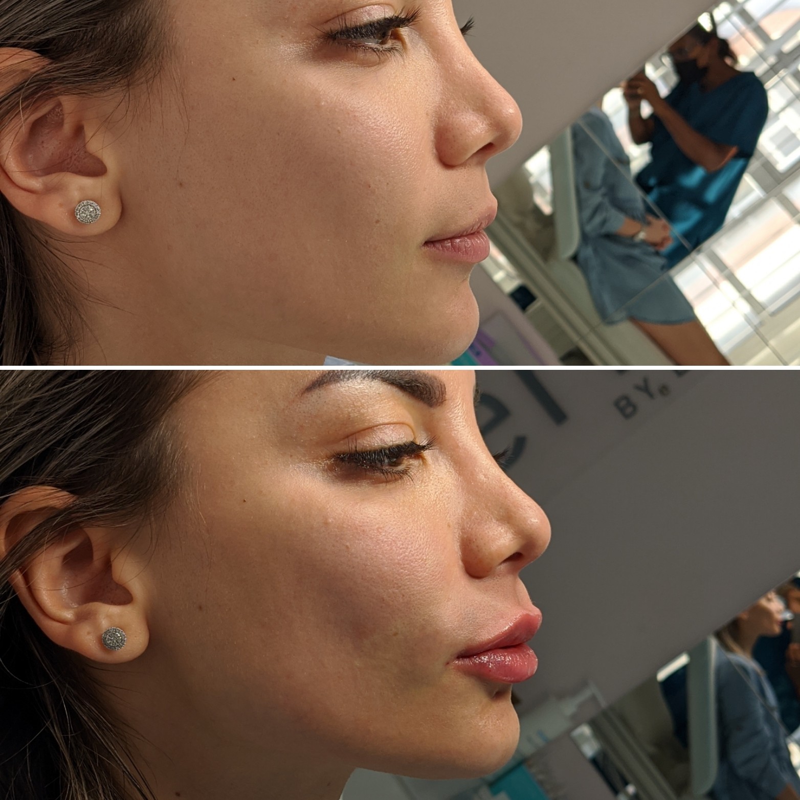 Profile balancing – Dr Melissa Clinic